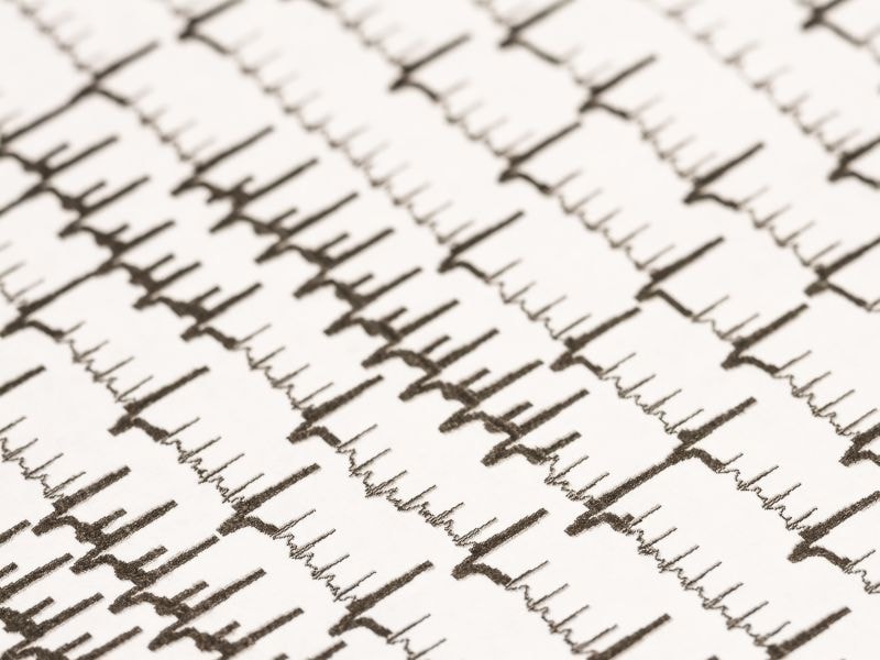 What's New in NICE Updated Atrial Fibrillation Guidance?