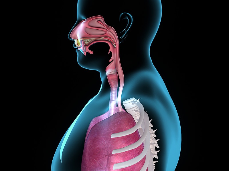 Airflow Obstruction and Occupational Exposure to Inhaled Pollutants