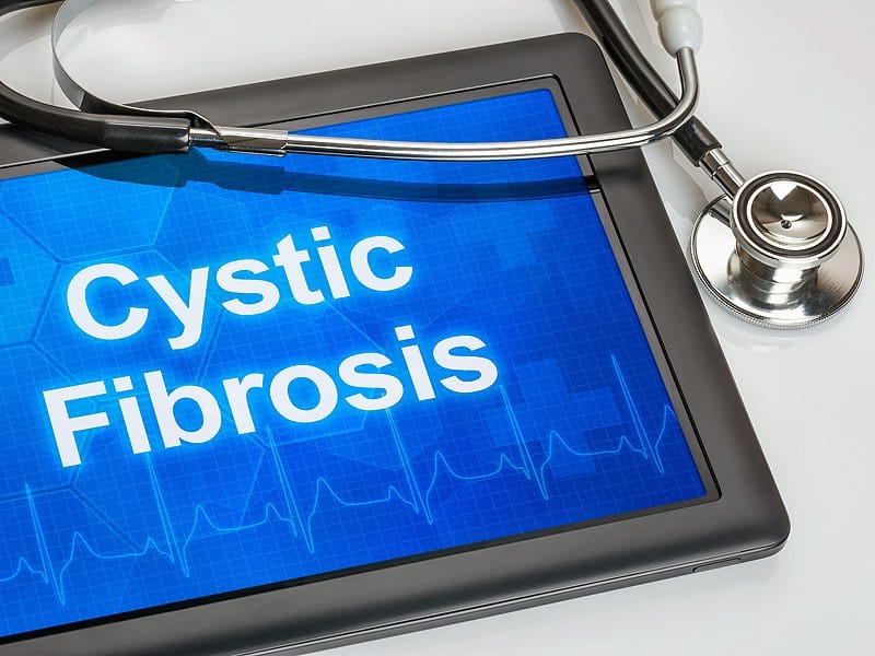 NHS to Offer New Cystic Fibrosis Therapy Alyftrek