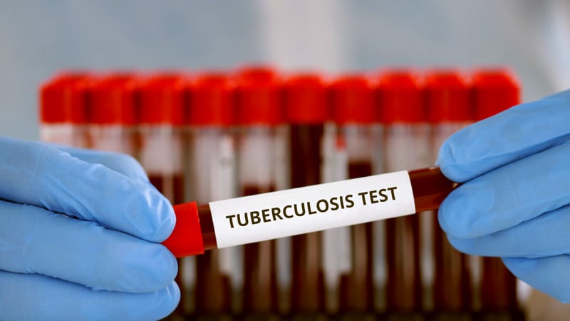 Chronic Kidney Disease Correlates With Increased Risk of Tuberculosis ...