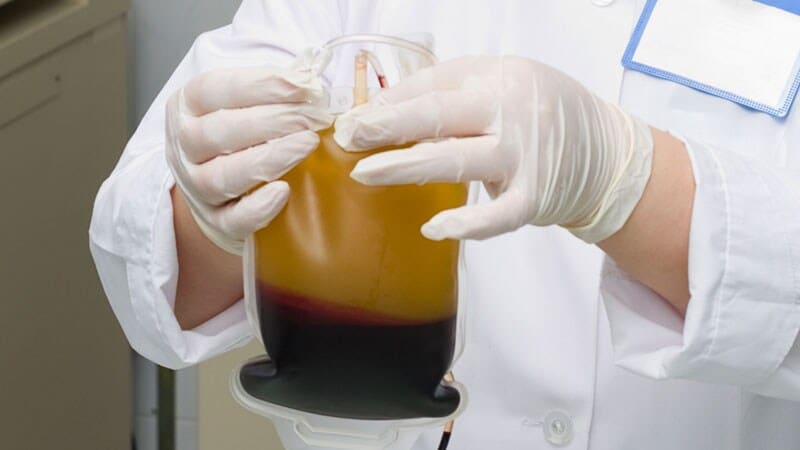 MHRA Re-assesses Ban on UK Plasma for Immunoglobulins