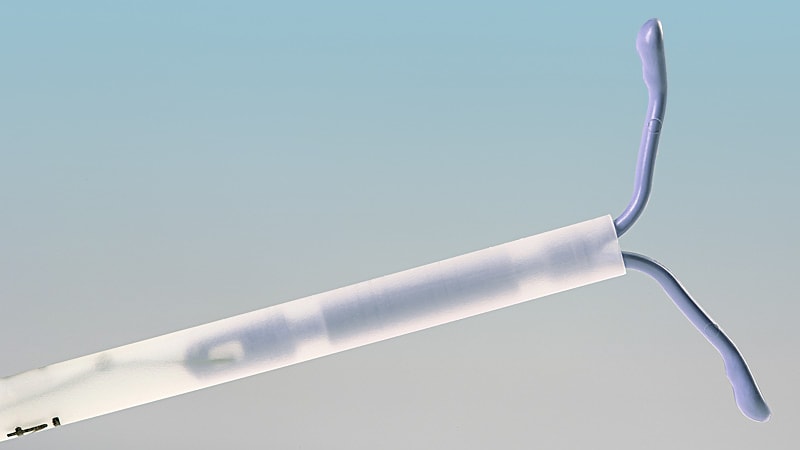 Lowest-Dose Intrauterine System Beats the Blues