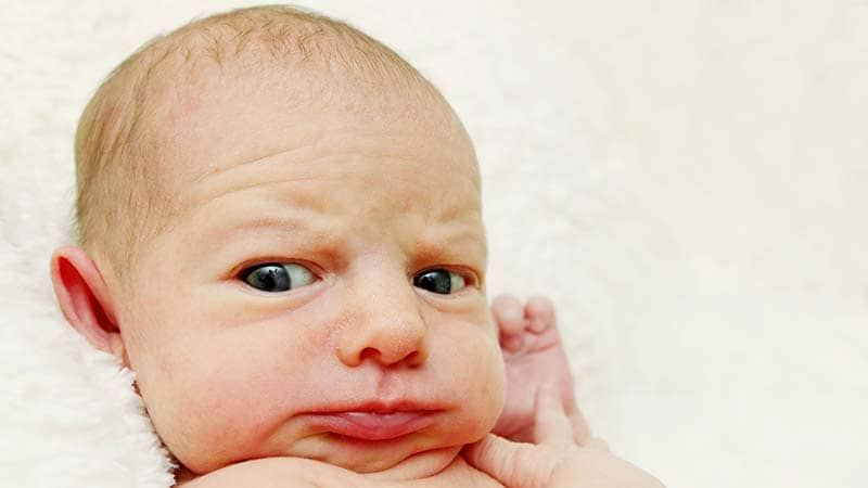 Micrognathie congénitale : isolée ou non