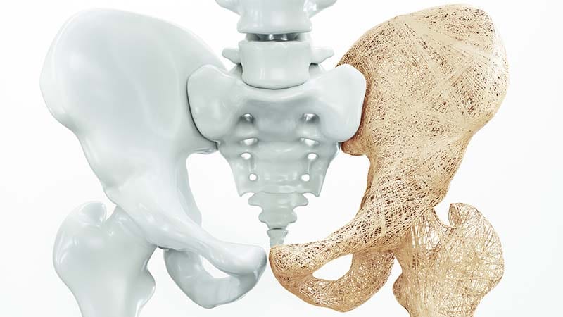 El tratamiento conservador es eficaz en los pacientes con cáncer rectal ...