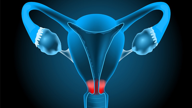 Pembrolizumab associé à la chimiothérapie dans les cancers du col ...