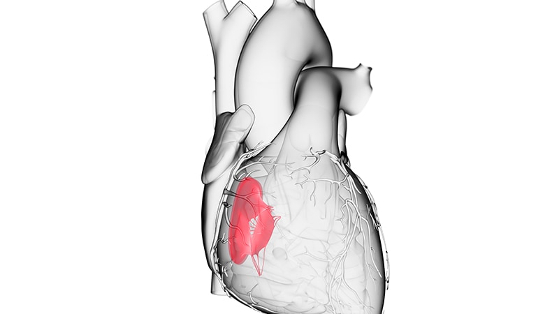 Remplacement transcathéter de la valve pulmonaire chez l’adulte : est ...