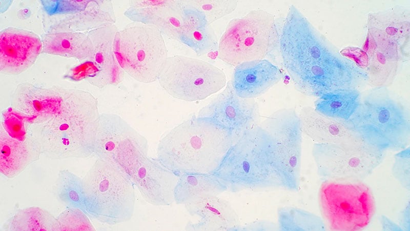 Traitement des carcinomes cutanés à cellules de Merkel