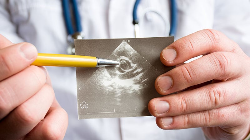 L’étude française RHEIA nous éclaire sur le RA chez les femmes