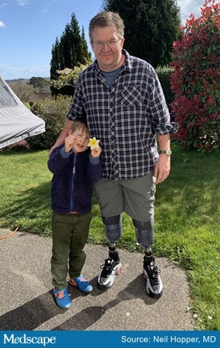 Sepsis Amputation Surgeon: What I Learned After Losing My Legs