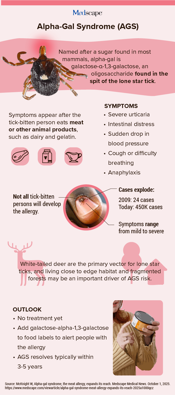Alpha-Gal Syndrome: For This Doctor, It’s Personal