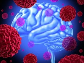 Injectable virus could help treat brain tumours