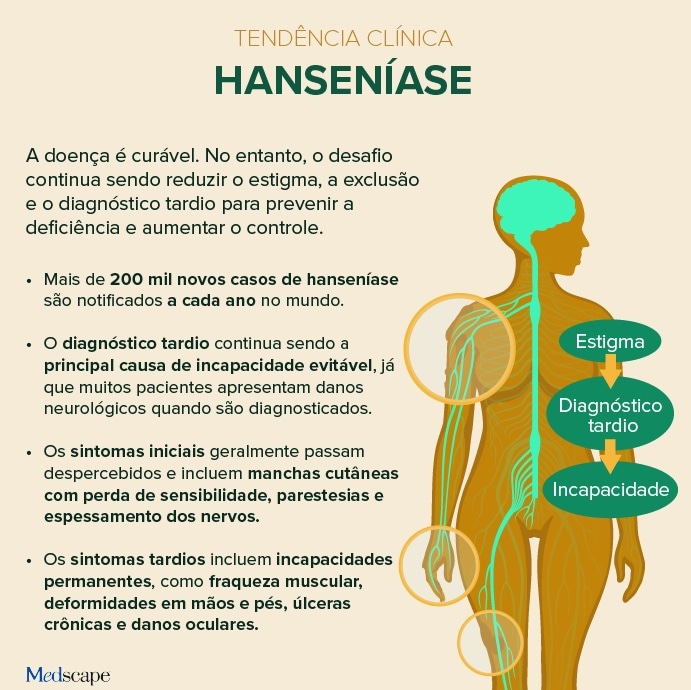 Tendência Clínica: Hanseníase