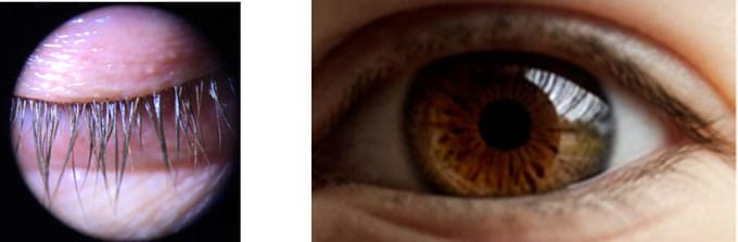 Figure 4. Representative Images from Janet’s 3-month Follow-up ...