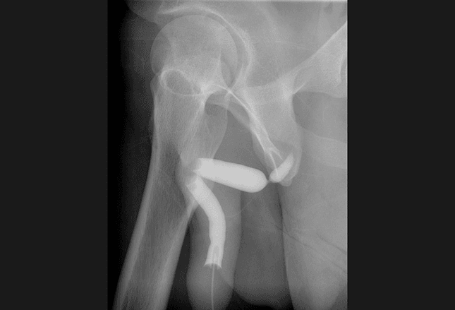 Dysuria: When It Hurts to Go With the Flow