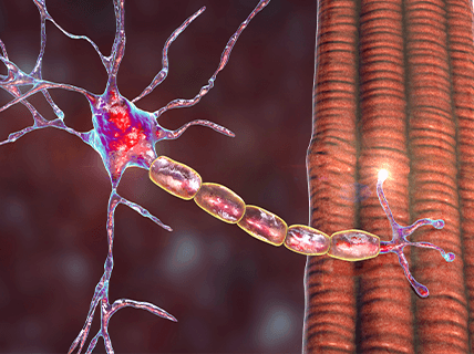 Diagnostic Challenges in Inclusion Body Myositis: Ruling Out the ...