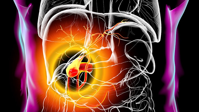 ¿Hay lugar para la colecistectomía profiláctica en Latinoamérica?