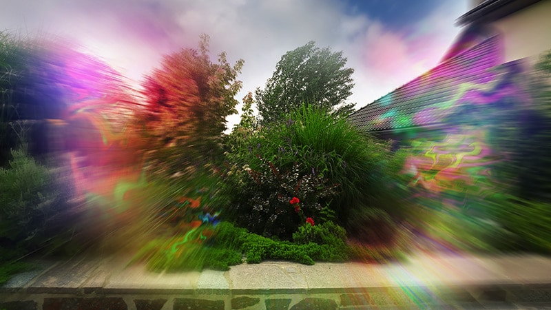 Post-Ablation Visual Auras a Sign of Transient Brain Injury?