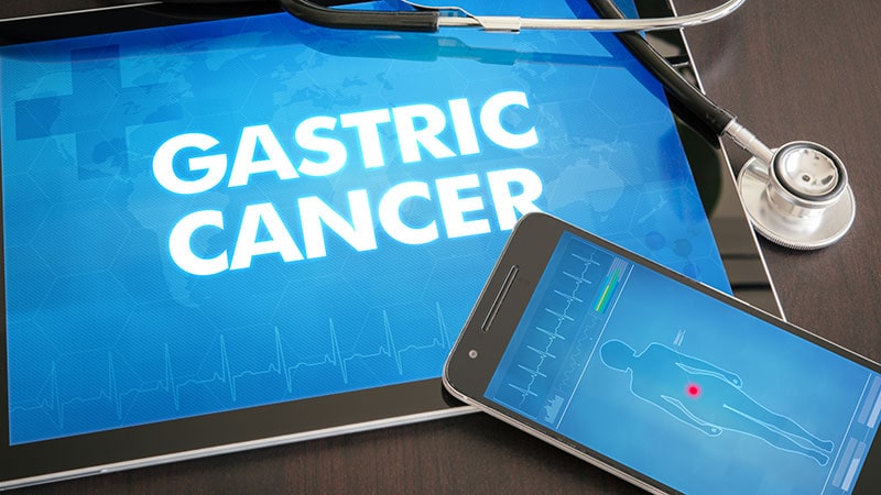 Alarming Rise in Early-Onset GI Cancers