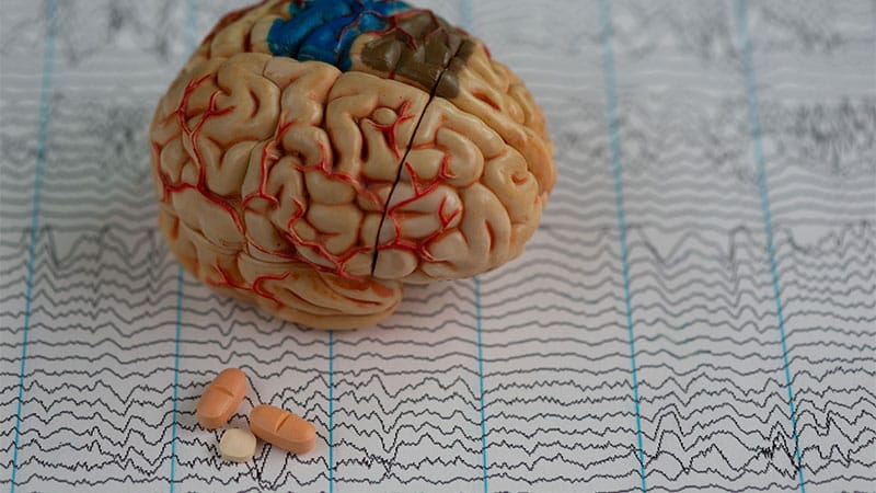 After Epilepsy Surgery, When to Stop ASMs Matters