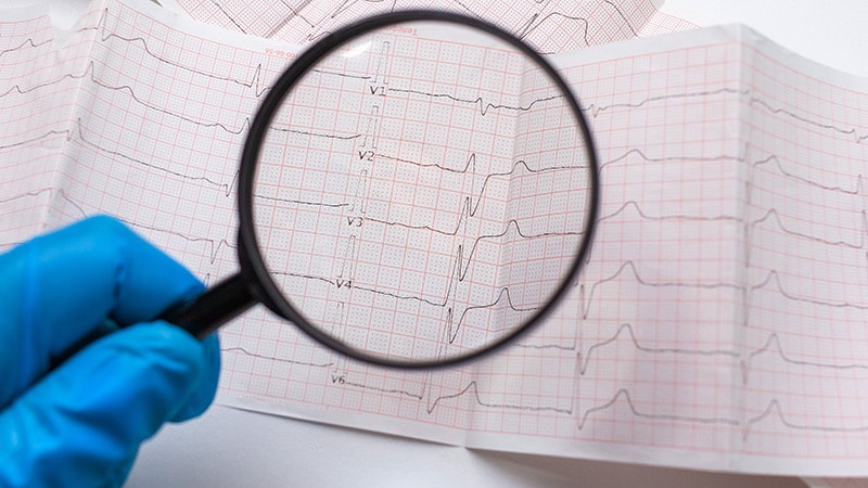 Remote ECG Screening Ups AF Detection ‘Modestly’