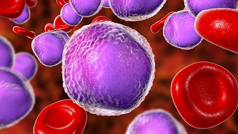 CAR-T Therapy Shows Promise in CNS and Extramedullary B-ALL