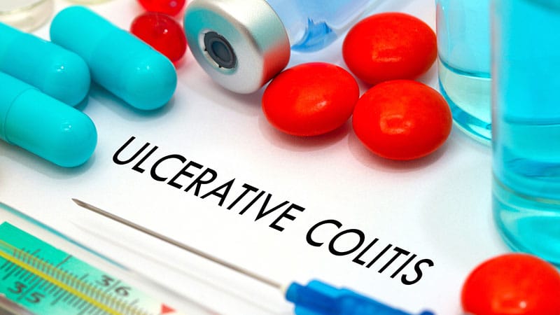 Longer Steroid Taper Improves Outcomes in Ulcerative Colitis