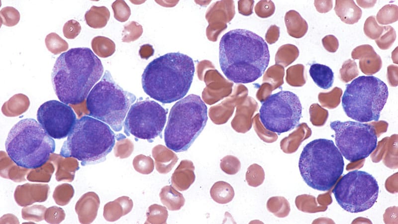 Arsenic-Based Tx Shows Superior EFS in Aggressive Leukemia