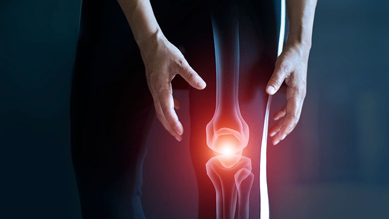 Rapid Review Quiz: Knee Pain