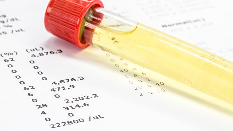 À la Une - Medscape