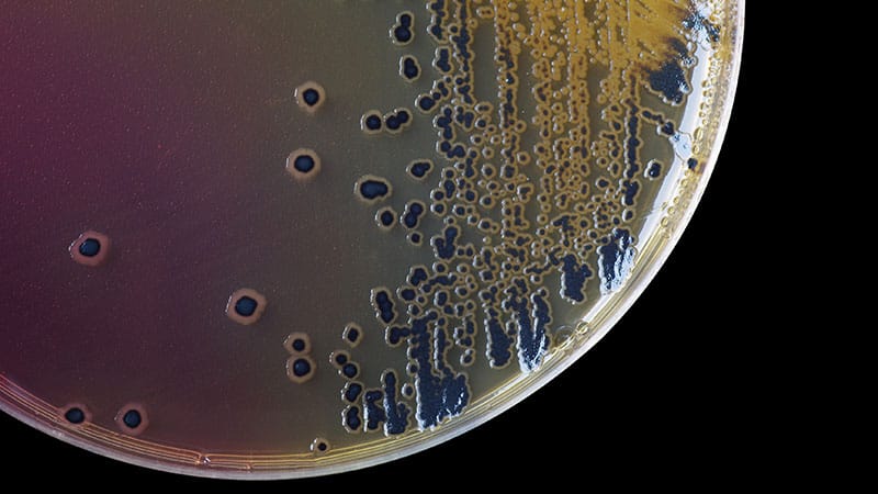 Rapid Review Quiz: Shigella