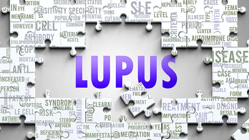 Belimumab Linked to Lower Relapse Risk in Lupus Serositis