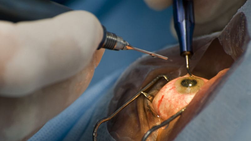 Scope of Practice in Eye Care: Pendulum Swinging Too Far?