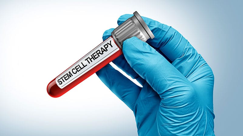 In MS, Stem Cell Transplant Sometimes Looks Like Cure