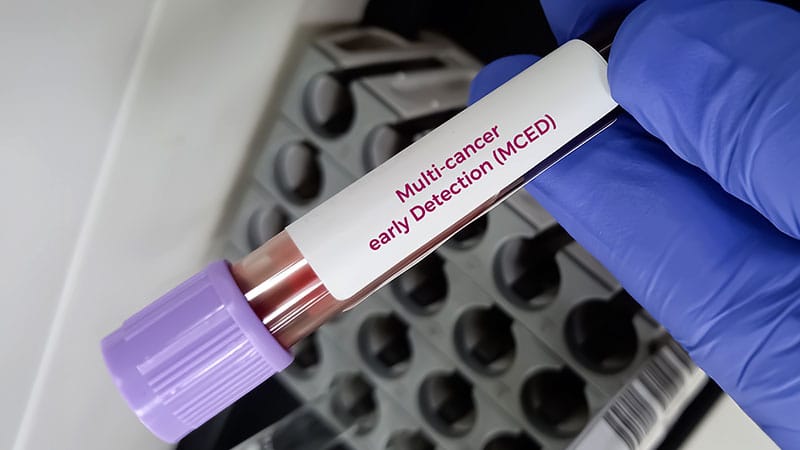 Inside the Major Findings From the NHS-Galleri Trial