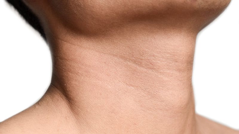 FDA Approves Hyaluronic Acid Filler for Reducing Neck Lines