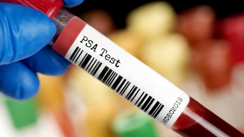 UK Failing Men on Prostate Cancer, Reports Warn