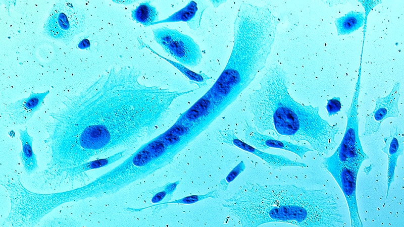 Prostate Cancer Center of Excellence | Medscape