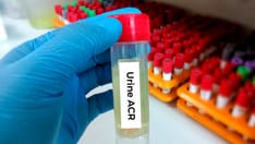 Dapagliflozin Can Reduce Liver Fat in Diabetes