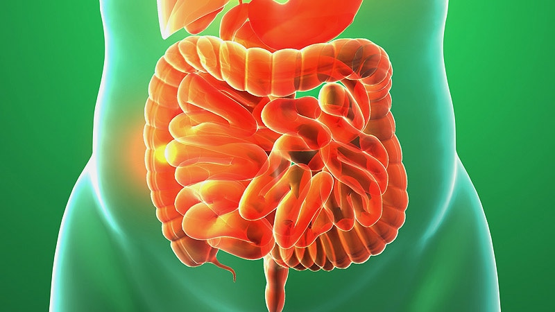 Inflammatory Bowel Disease | Medscape