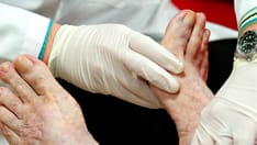 From Healing to Remission: Managing Diabetic Foot Ulcers
