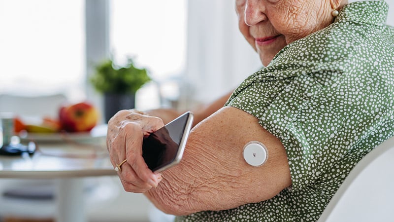 CGM With Geriatric Care Simplifies T1D Management in Seniors