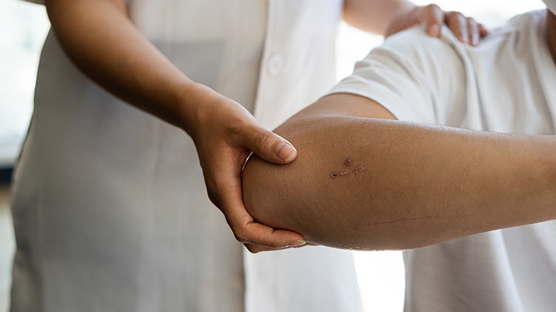 Hospital Competition Drives Unnecessary Surgeries for MSDs