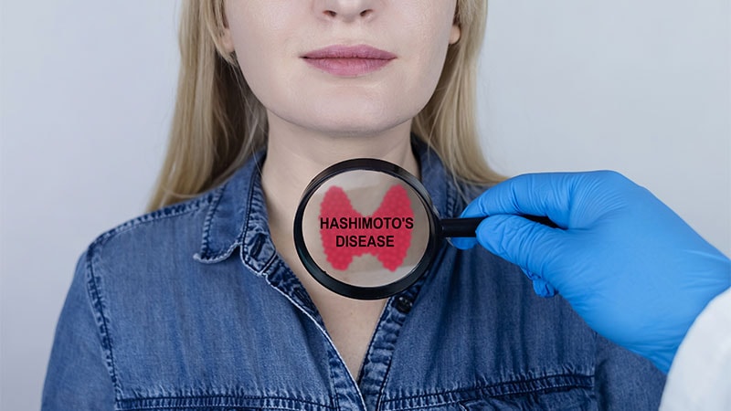 Family Ties May Shape Hashimoto Thyroiditis Risk