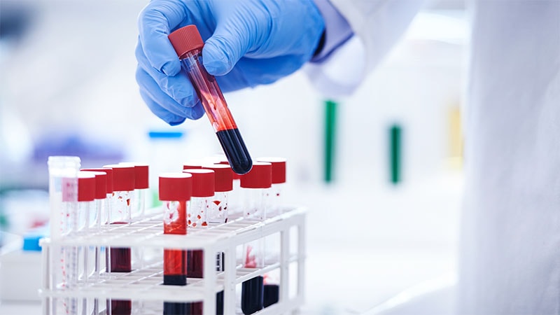 Blood Culture Time Tied to Severity in Blood-Borne Infection