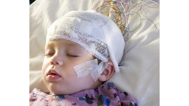 Thrombectomy Bests Medical Therapy for Pediatric M2 Stroke