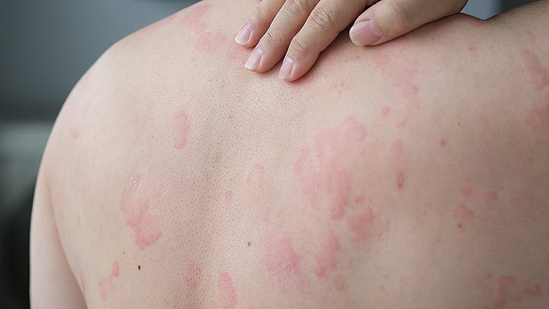 Dermatology - Medscape