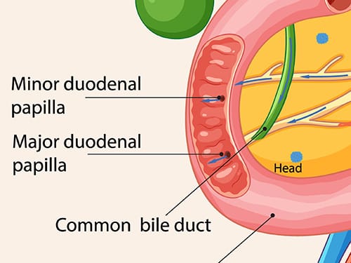 Worsening Abdominal Pain With Diabetes