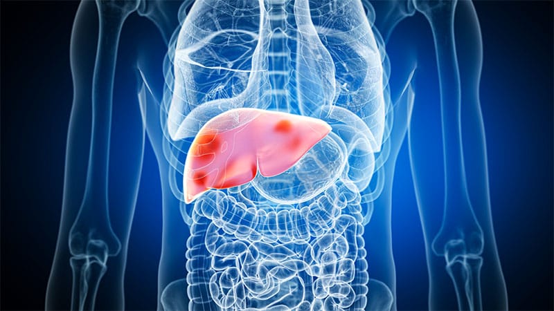 Is MRI-Guided SBRT Safe for Liver Metastases?