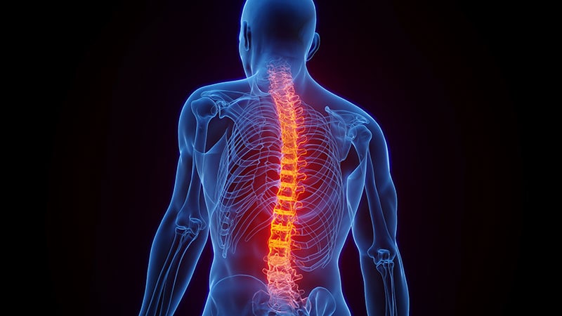 El desfibrilador vestible Kestra ASSURE: nueva evidencia en prevención ...