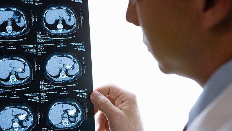 Can Periportal Halo on CT Predict Transplant Complications?